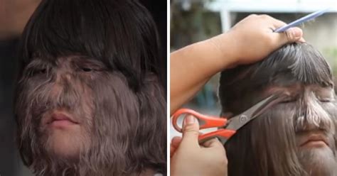Bullied Girl Transforms Into Beautiful Woman After Shaving Her Face