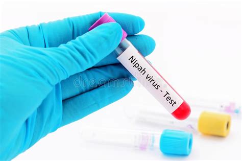 Nipah Virus Test Stock Image Image Of Medical Pestilence 117961893