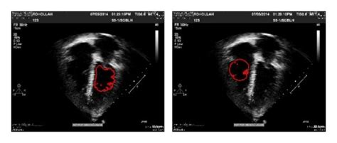 Visual Results Of Geometrically Constrained Level Set Segmentation Download Scientific Diagram