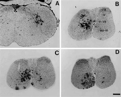 Detection Of Mhv In The Dorsal Reticular Nucleus And In The Gray And