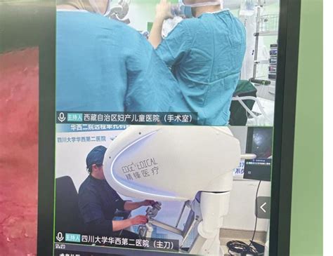 全国首例远程单臂单孔机器人手术在拉萨成功完成中国高新网