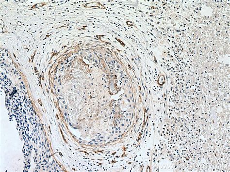 Collagen Type Iv Antibody 55131 1 Ap Proteintech