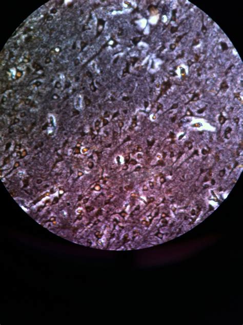 Nervous System — See Why Anatomy