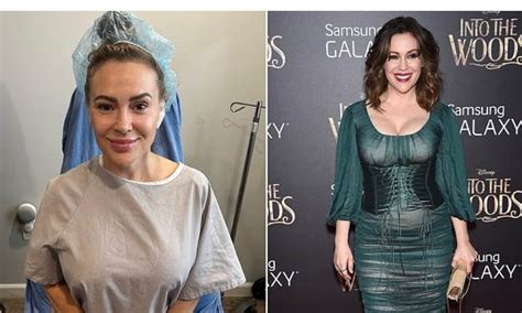 “alyssa Milanos Brave Transformation Actress Removes Breast Implants
