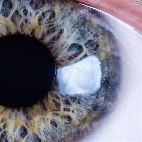 Inflammation Régénération Réparation Comment Le Foie Réagit à L