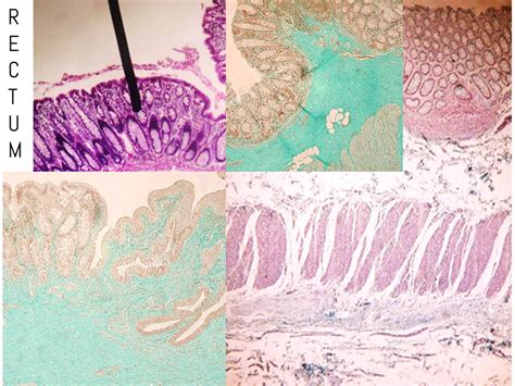 A Histology Tour Of The Gi Tract The Colon Rectum And Anus