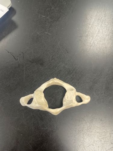 Lab Flashcards Quizlet