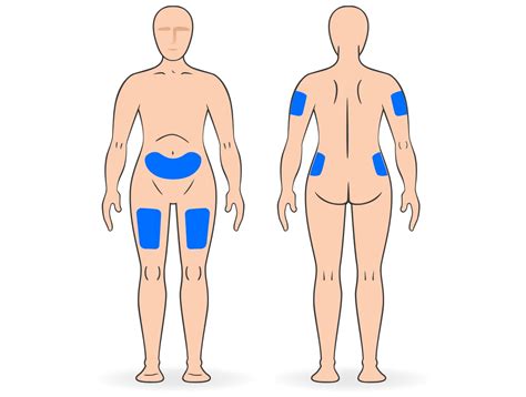 Subcutaneous Injection Sites And Instructions For Safe Self Administration
