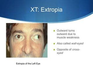 Abbreviations Of The Ear And Eye Pptx