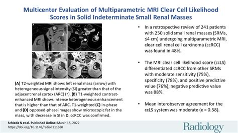Multicenter Evaluation Of Multiparametric Mri Clear Cell Likelihood
