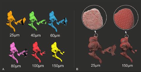 Image A Shows 3d Reconstruction Of The Ossicular Chain With Reducing