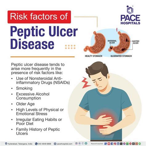 Peptic Ulcer Types Symptoms Causes Diagnosis And Treatment
