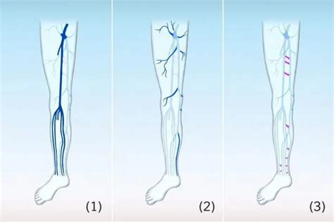 Venous System Structure And Functions Medicine