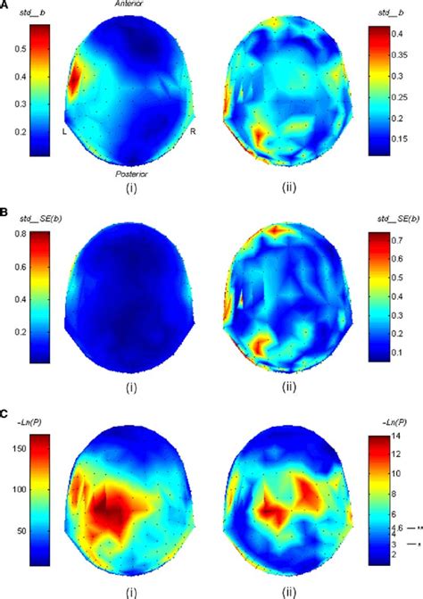 Spatial Distribution Of The Relations Of Meg Signals To Movement Speed