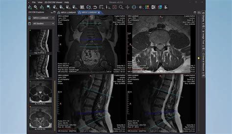 Weasis Dicom Viewer Download Latest 2025 Filecr