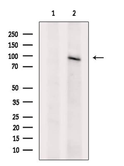 Invitrogen Vldlr Polyclonal Antibody 100 μl Unconjugatedantibodies