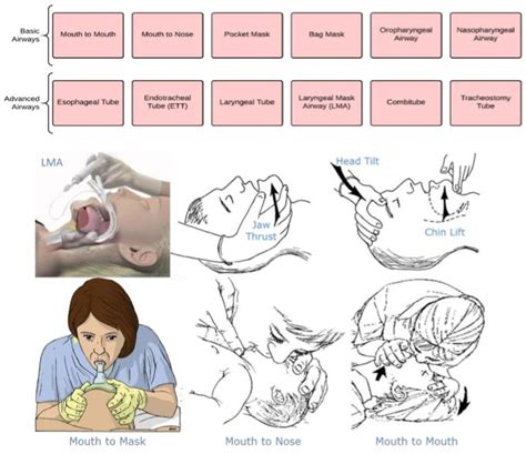 FREE ACLS Study Guide ACLS Made Easy Acls Study Acls Study