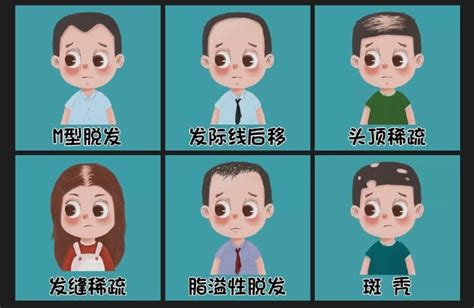 深圳植发选公立医院还是私立医院？植发医生怎么选？别大意，医院医生选择都很重要！ 知乎