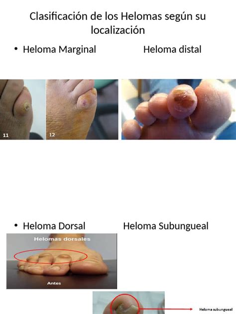 Clasificación De Helomas Por Localización Pdf Religión Y