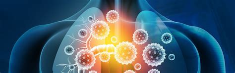 Down Syndrome Associated With Serious Respiratory Complications R