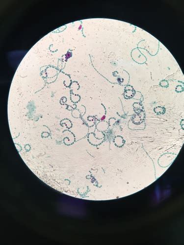 Prokaryotes Lab Flashcards Quizlet