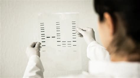 Plasmid Dna Plasmidfactory Gmbh