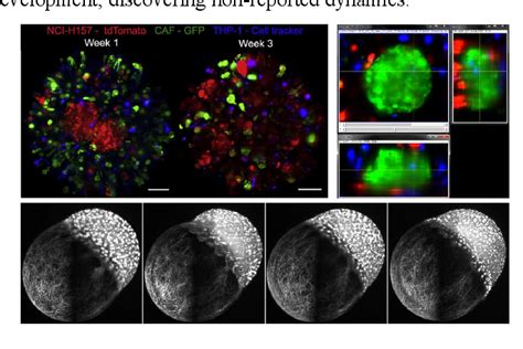 Figure 2 From High Throughput Live Imaging Using Light Sheet Microscopy Semantic Scholar
