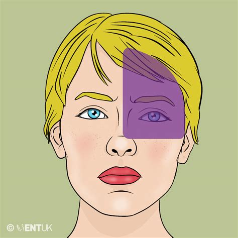 Bruised Cheekbone Feeling