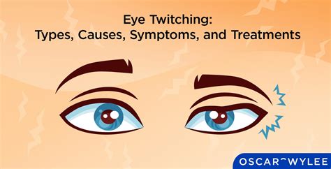 Understanding Eye Twitching Causes Symptoms And Treat - vrogue.co
