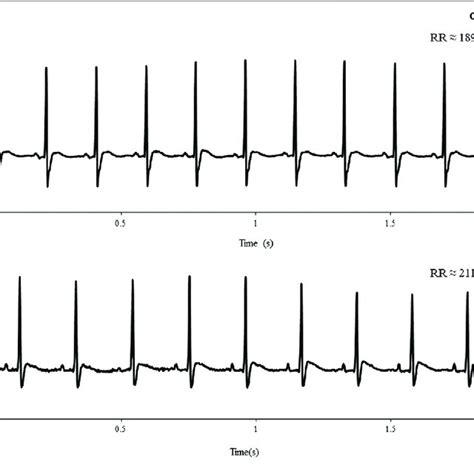 Representative Telemetric Ecg Tracings Recorded In A Control A And