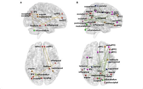 Correlations Between The Functional Connection Classification Scores