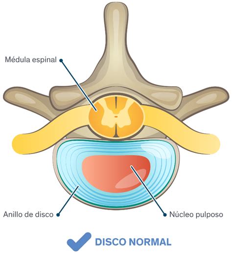Clínica de Especialistas en Columna Vertebral | Centro Médico ABC