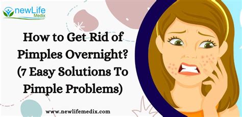How To Get Rid Of Pimples Overnight 7 Effective Solutions