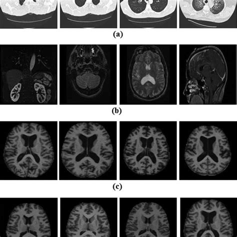 sample biomedical images from a hrct dataset b nema mri dataset