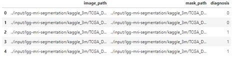 Github Piyush Mri Dataset Brain Disorders Detection Model
