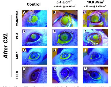 Figure 1 From The Effect Of Standard And High Fluence Corneal Cross Linking Cxl On Cornea And