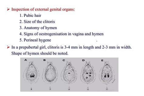 Pediatric And Adolescent Gynecology Koc Univ Web Pptx