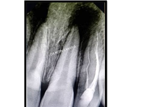 Nature Keeps Surprising And We Keep Learningmax Lateral