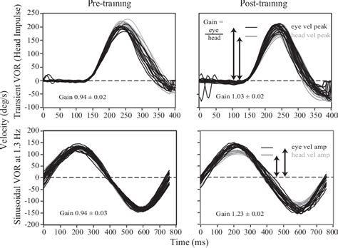 Figure 2 From Human Vestibulo Ocular Reflex Adaptation Is Frequency Selective Semantic Scholar