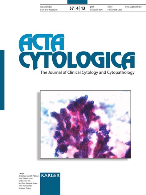 Interactions Of Actinomyces Like Organisms With Host Cells Light