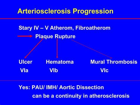 Aortic Ulcer Intramural Hematoma Aortic Dissection Ppt