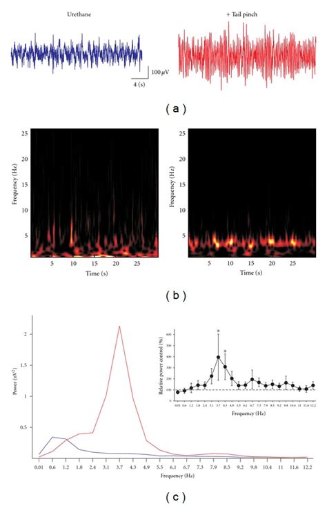 Sensory Stimulation Induces Hippocampal Theta Oscillations A