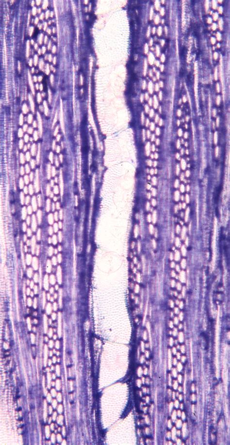 Xylem Longitudinal Section