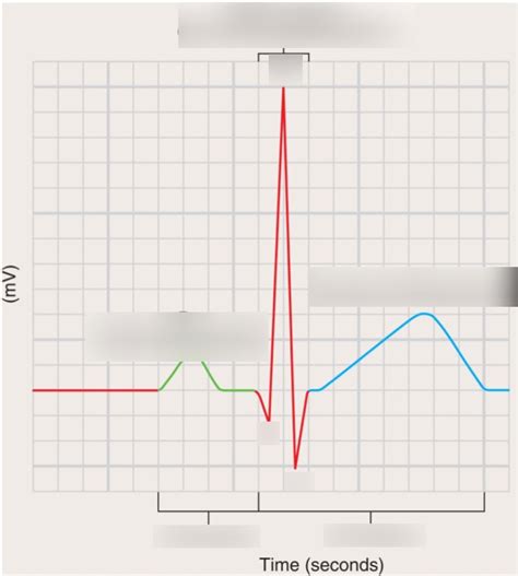 Bio 251 Cardiac Ekg Diagram Quizlet