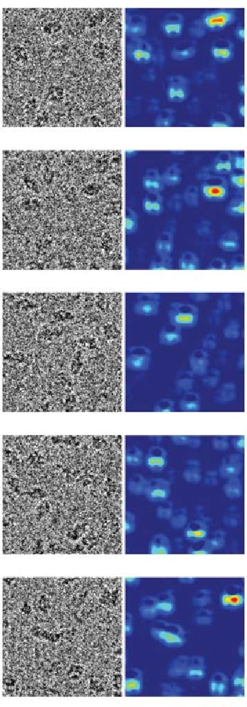 figure 4 from automated particle picking in cryo electron micrographs