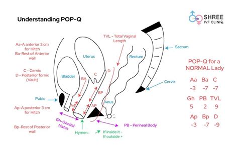 Pelvic Organ Prolapse Treatment In Mumbai Uterine Prolapse