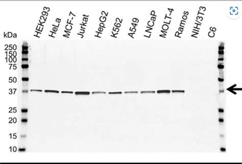 Solved Describe The Results Of The Attached Western Blot In Chegg Com
