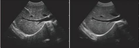 Advanced Cardiac Ultrasound Scan Machine Narula Exports