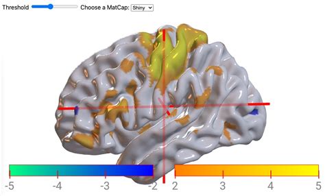 add matcap effects · issue 477 · niivue niivue · github