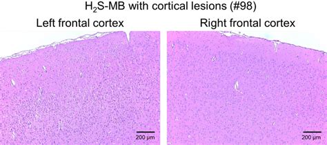 Histology Of The Frontal Cerebral Cortex In One Rat Of The H2s Mb Group Download Scientific